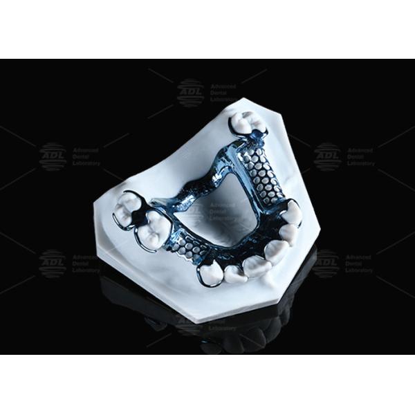 China Hypoallergenic Adjustable And Customizable 3D Printed Titanium ...