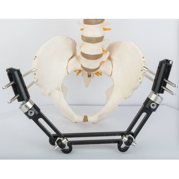 China Surgical Orthopedic External Fixator T Type For Pelvic Fractures ...
